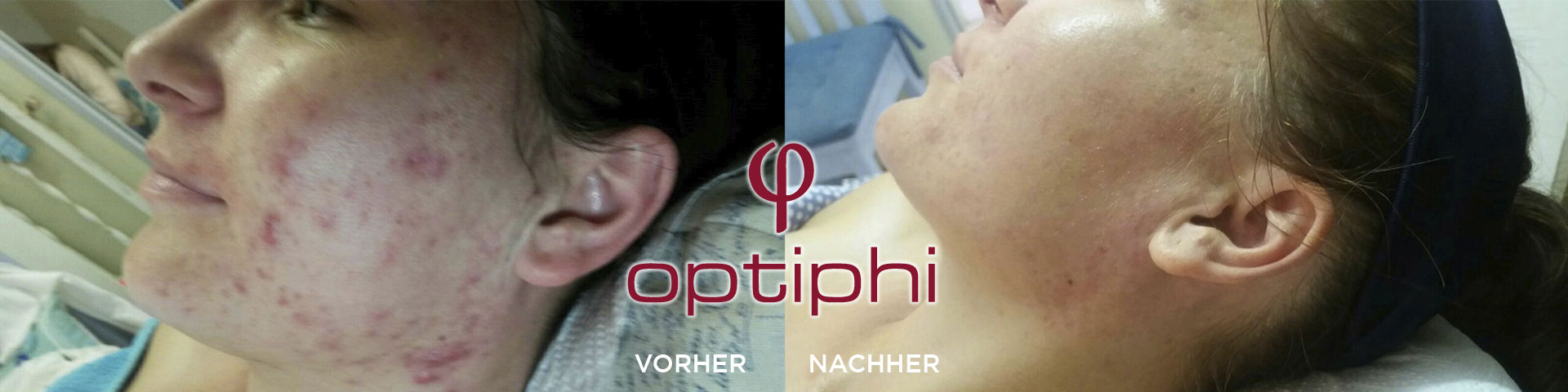 Das Pubertier - Pulchris in Lienz